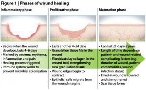Stages Of Soft Tissue Healing • Bodybuilding Wizard