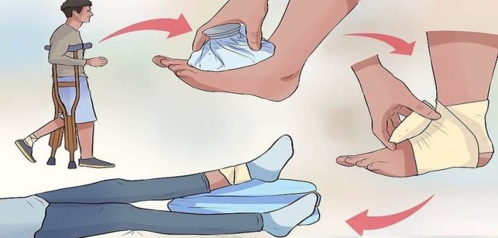 Treating injuries using RICE method • Bodybuilding Wizard Treating injuries using RICE method • Bodybuilding Wizard